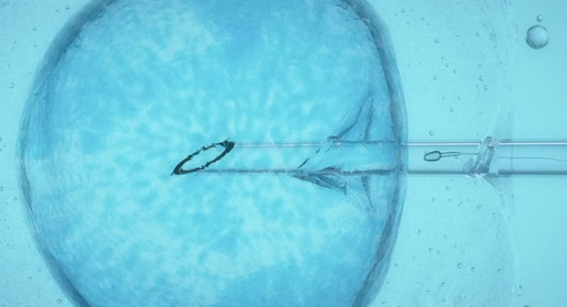 ICSI-Station - IVF Express